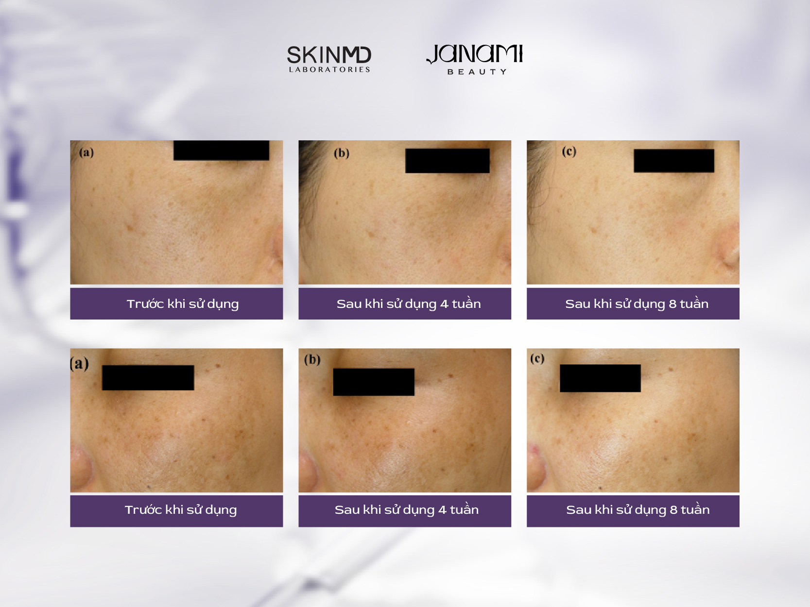 Kem SkinMD Pure Whitenol - Giảm thâm nám và dưỡng trắng da