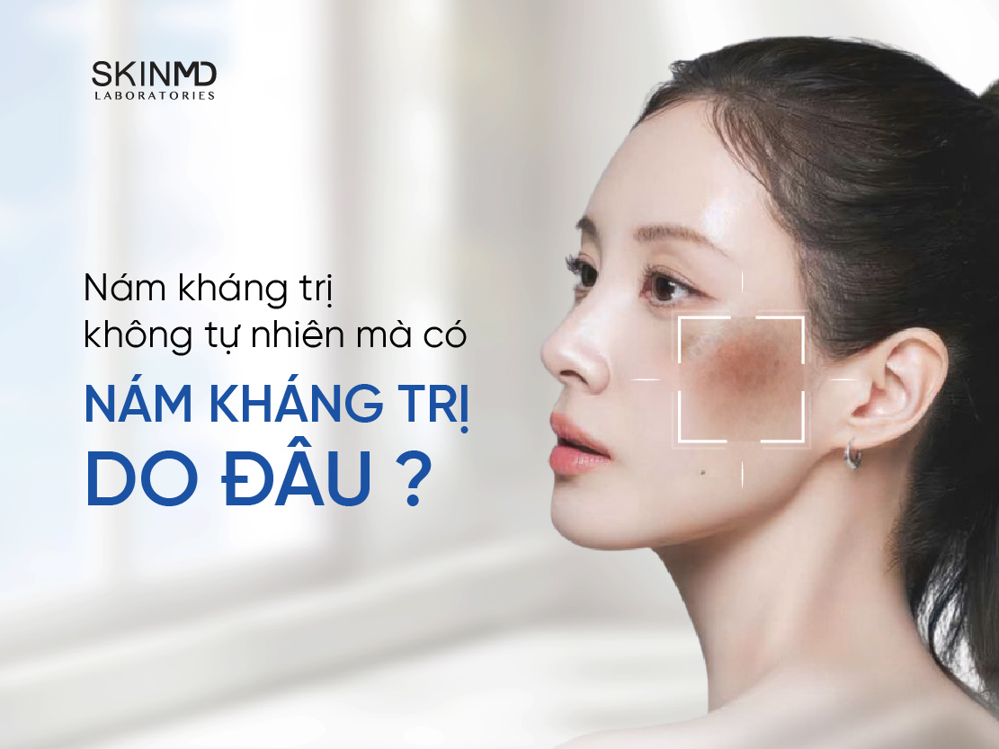 Nám kháng trị do đâu? 5 nguyên nhân gốc rễ cần biết để điều trị hiệu quả